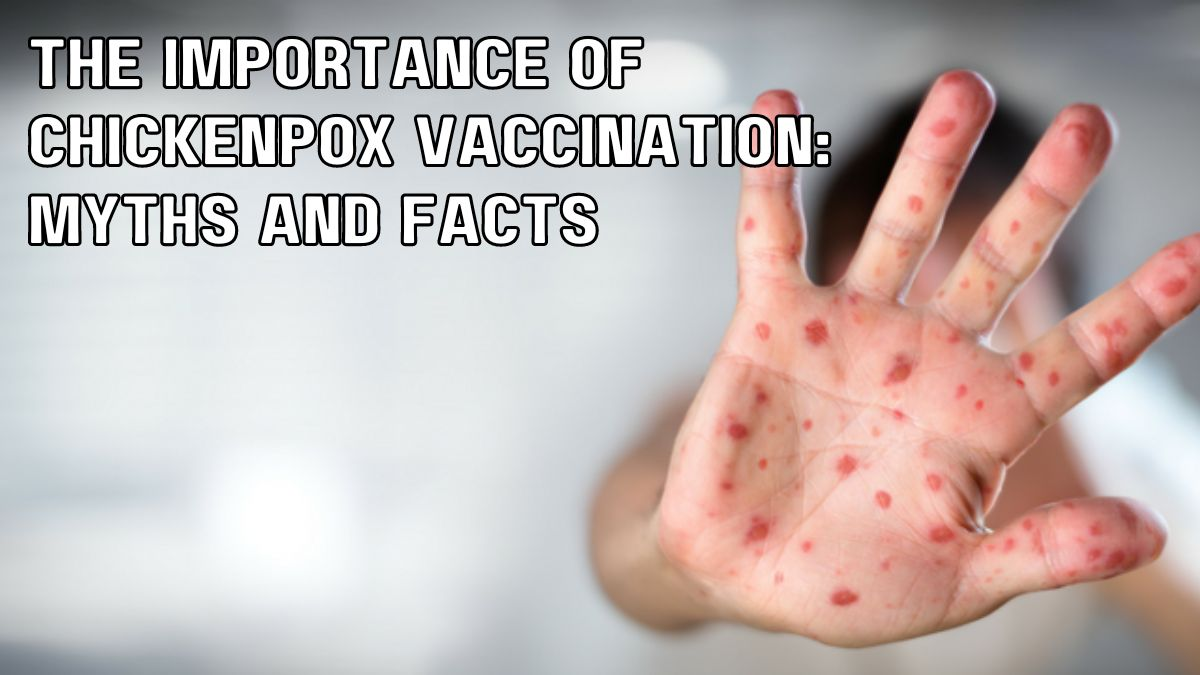 Unveiling Chickenpox: Causes, Symptoms, Myths, and Comprehensive Care ...