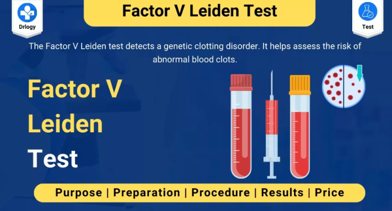 Factor V Leiden: A Comprehensive Guide to the Genetic Clotting Disorder ...