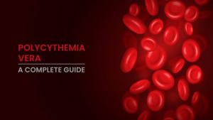 Understanding Polycythemia Vera: A Guide to the Overproduction of Red ...
